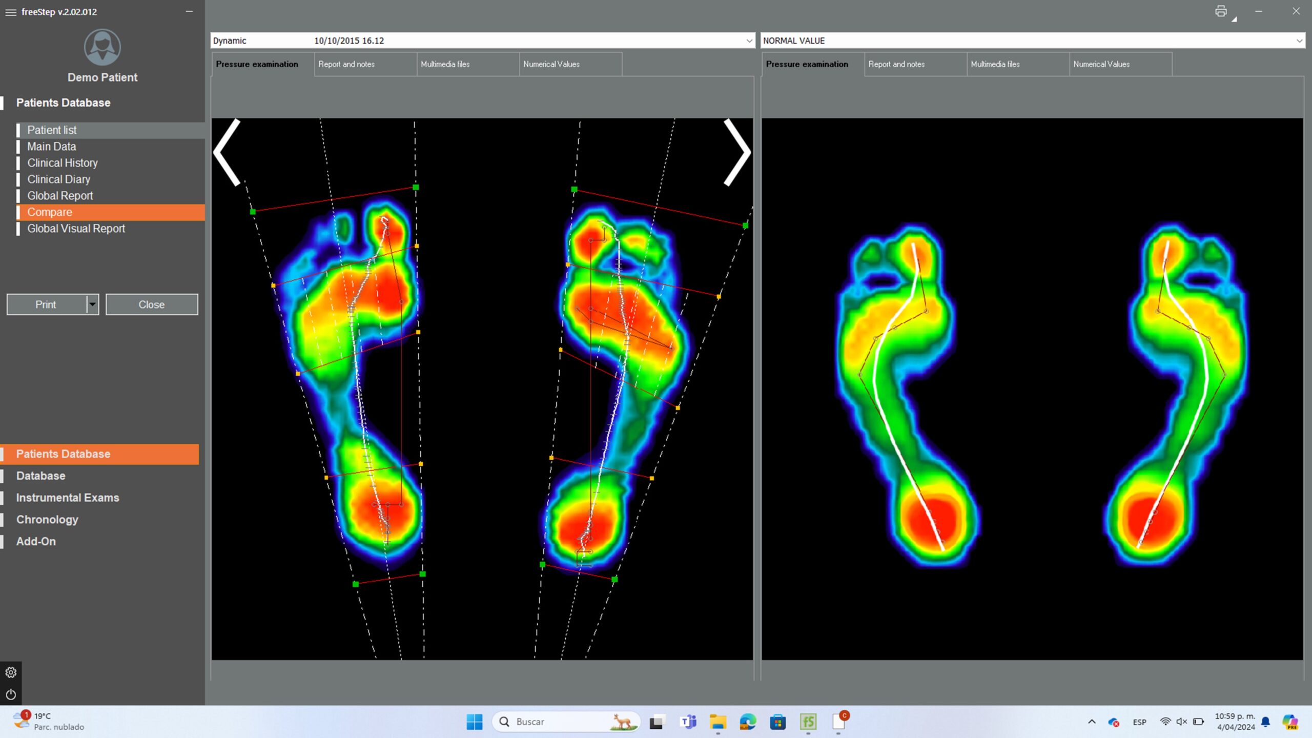 Biomechanical analysis - freeStep - Sensor Medica