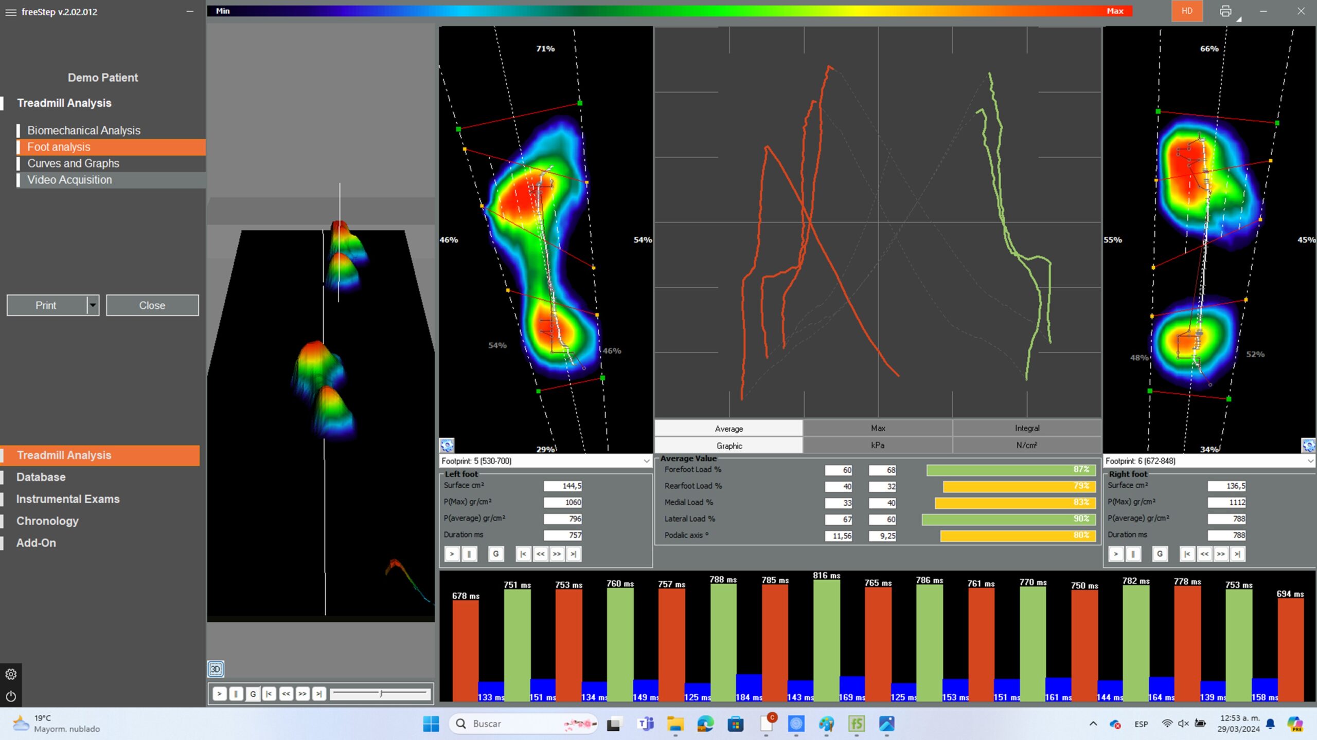 Professional gait & run analysis - Baropodometric Treadmill