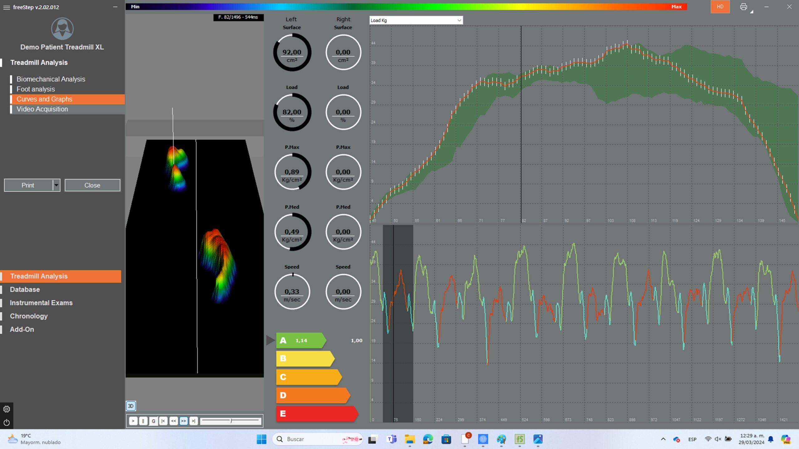Professional gait & run analysis - Baropodometric Treadmill