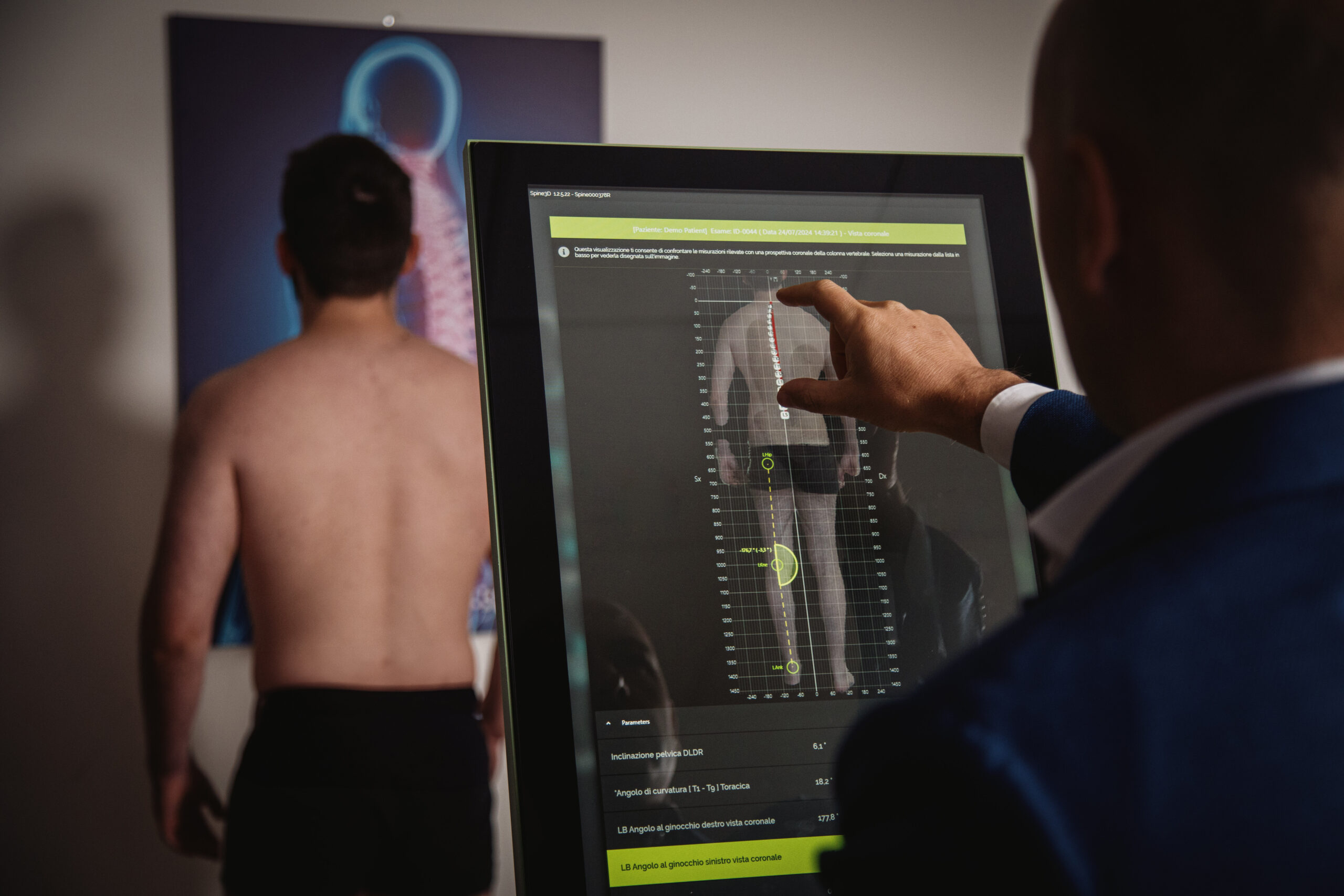Non-invasive 3D scan of the spine - Posture Analysis